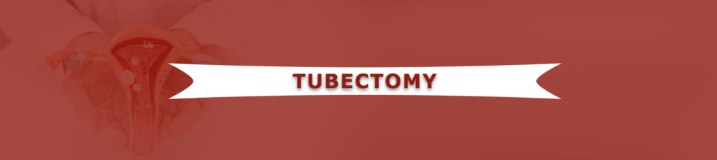 TUBECTOMY – ROHINI HEIGHTS